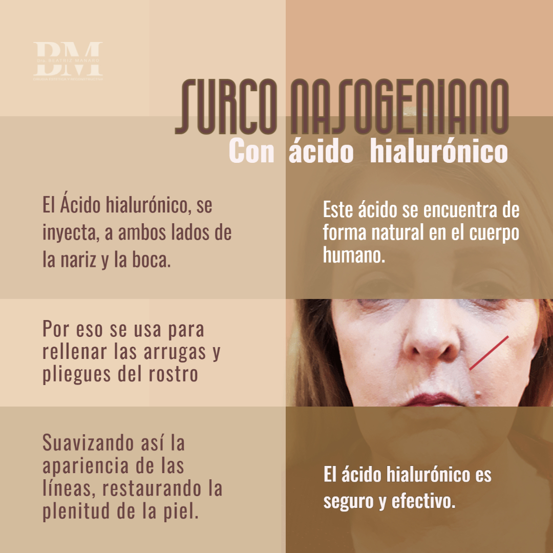 Surco Nasogeniano – Dra. Manaro